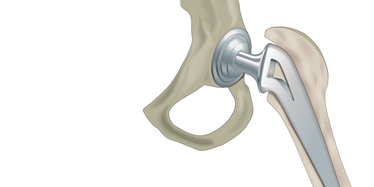 Milling tooling developments increase quality and productivity in the ...